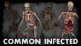 Common Infected Mods - Left 4 Dead 2 - GameMaps